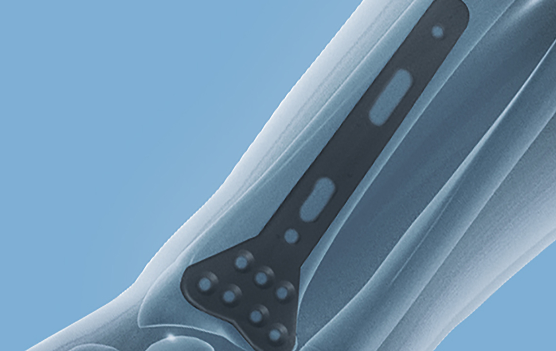 Implantable Peek Materials | Polymers for Medical Devices - Victrex